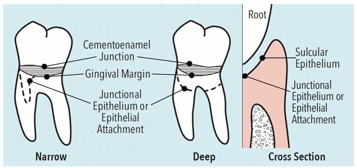 extend-reach-1 - Dimensions of Dental Hygiene | Magazine