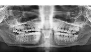 X-ray figure 11 - Dimensions of Dental Hygiene | Magazine