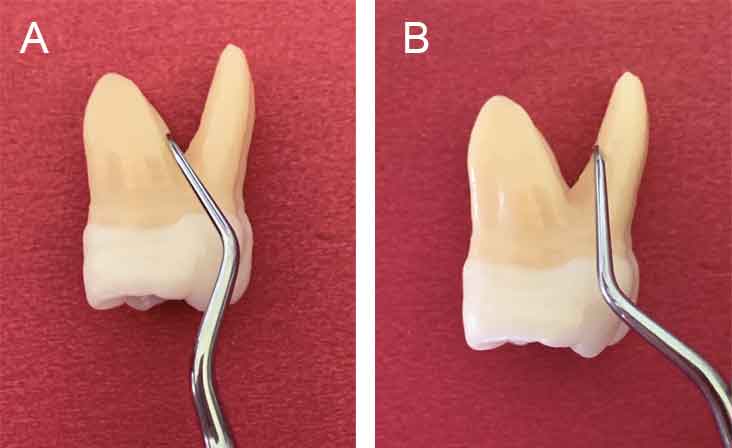 0921-dodh-roots-7 - Dimensions of Dental Hygiene | Magazine