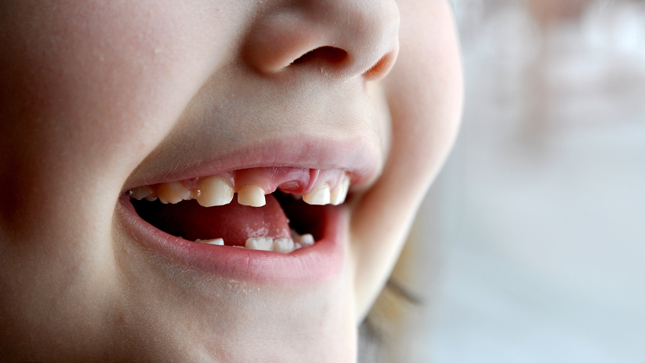 baby-teeth-featured - Dimensions of Dental Hygiene | Magazine