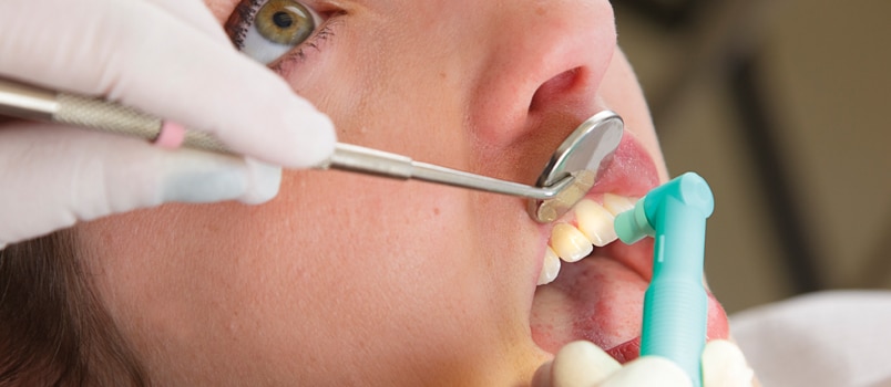 The Science of Polishing - Dimensions of Dental Hygiene