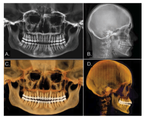 CBCT Imaging In Orthodontics - Dimensions of Dental Hygiene