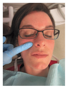 Alternative Injection Techniques - Dimensions of Dental Hygiene