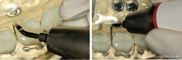 Adapting Site-Specific Ultrasonic Inserts/Tips