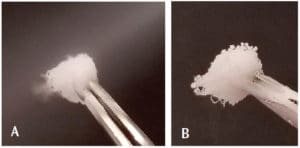 Endodontic Diagnosis for the Dental Hygienist