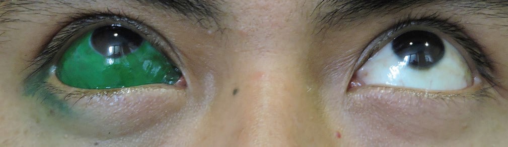 Extreme Body Modifications - Dimensions of Dental Hygiene