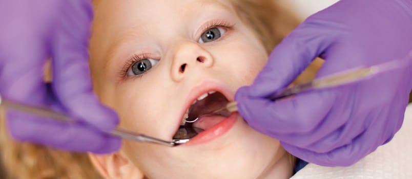 A Comprehensive Approach to Dental Caries Management - Dimensions of ...