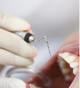 New Perio Classification System Explained - Dimensions of Dental Hygiene