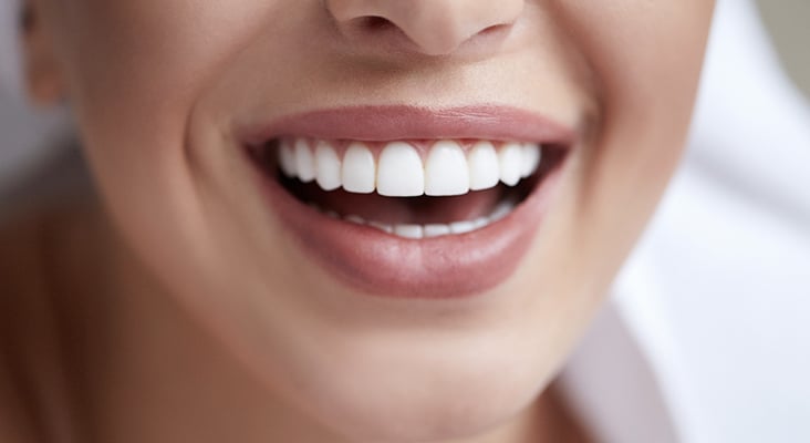 Surgical Approaches to Gingival Recession