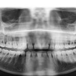X-ray figure 9 New - Dimensions of Dental Hygiene | Magazine