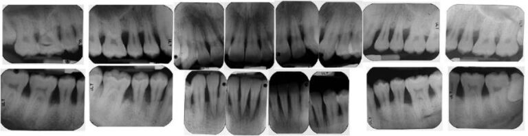 What Oral Health Professionals Need to Know About the AAP’s ...