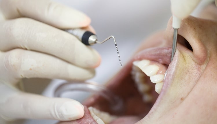 Risk-Based Recare for Perio Maintenance - Dimensions of Dental Hygiene