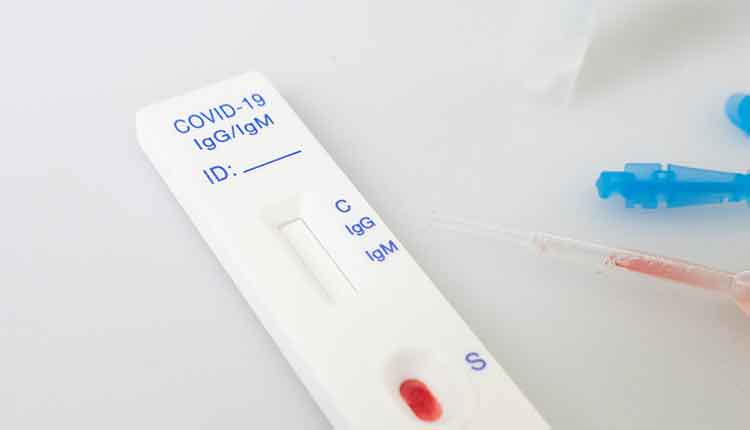 FDA Approves Over-the-Counter COVID-19 Tests Available Without a ...