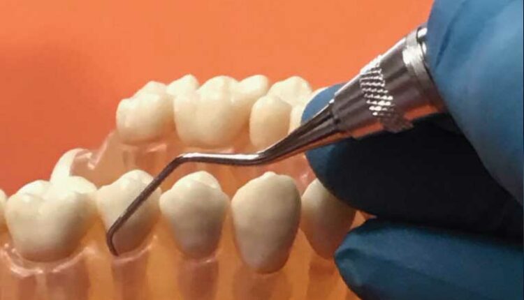 extend-reach-8 - Dimensions of Dental Hygiene | Magazine