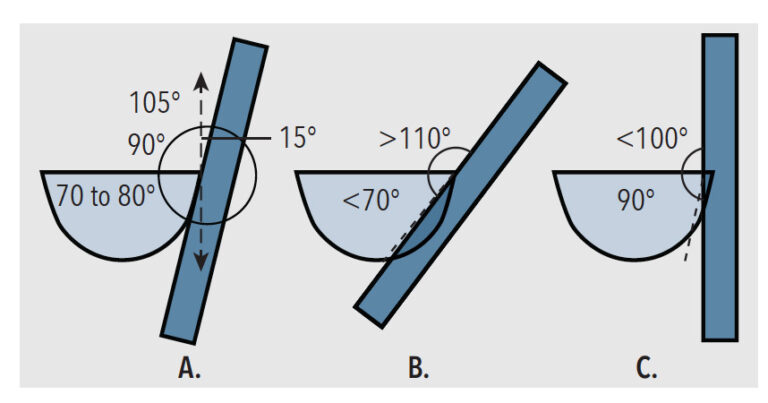 How to Keep Instruments Sharp - Dimensions of Dental Hygiene