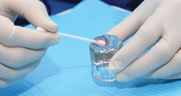 The Keys to Caries Management - Dimensions of Dental Hygiene