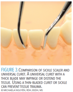 Anatomy of Instrument Design and Selection - Dimensions of Dental Hygiene