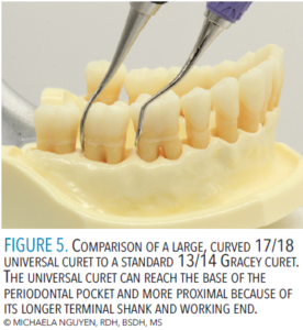 Anatomy of Instrument Design and Selection - Dimensions of Dental Hygiene
