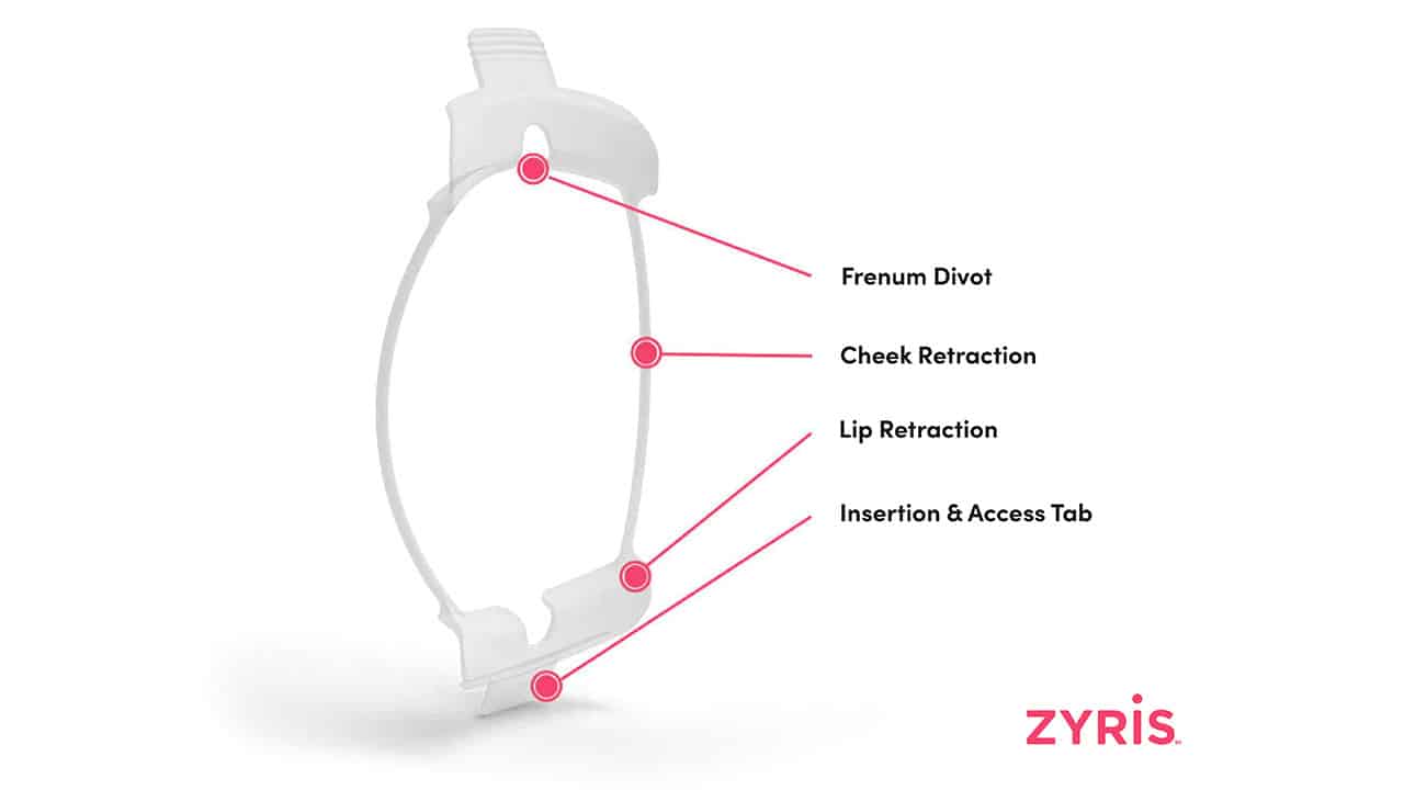 Introducing the Zyris Retractor - Dimensions of Dental Hygiene
