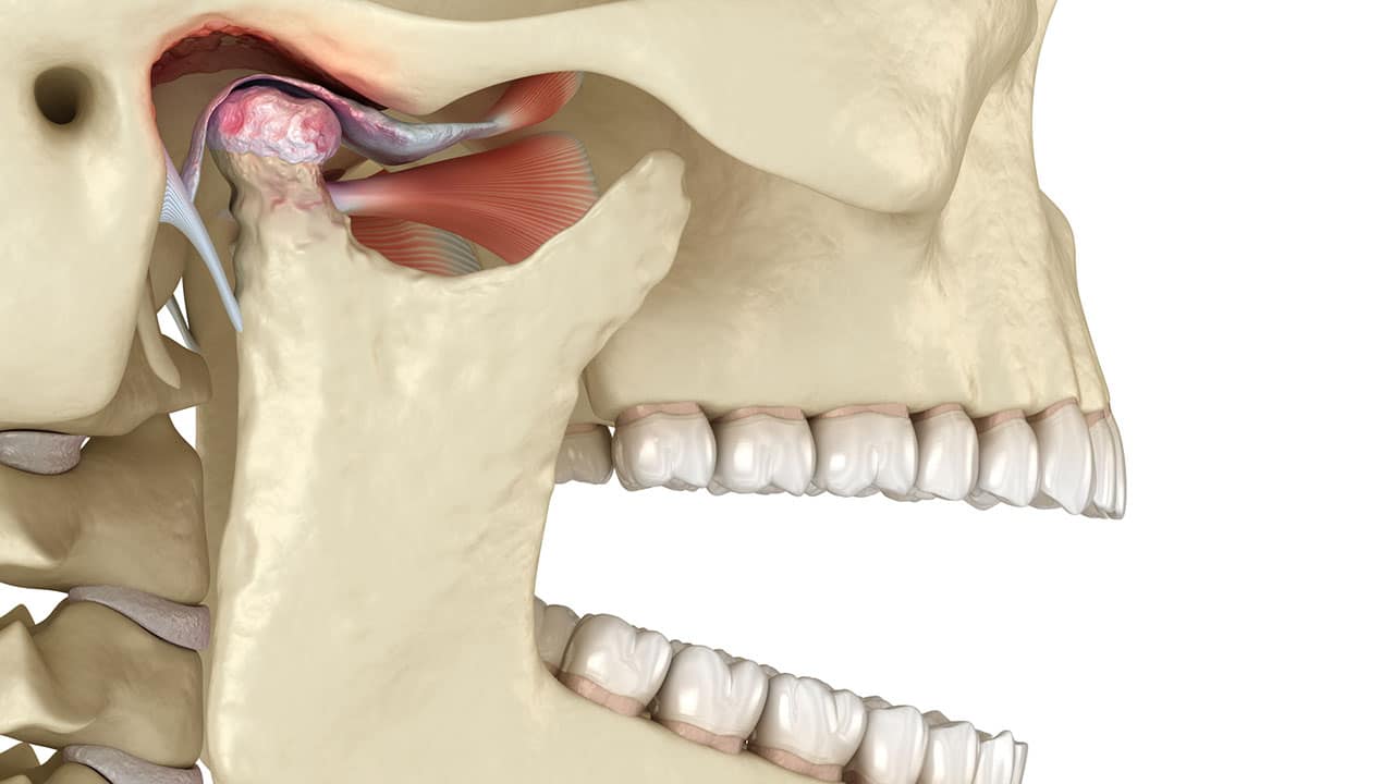 Milwaukee’s Dental and Medical Schools Collaborate to Tackle TMD ...
