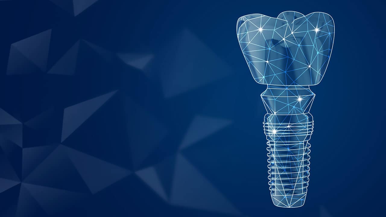 Penn Dental Medicine Researcher Designs Innovative Implant - Dimensions ...