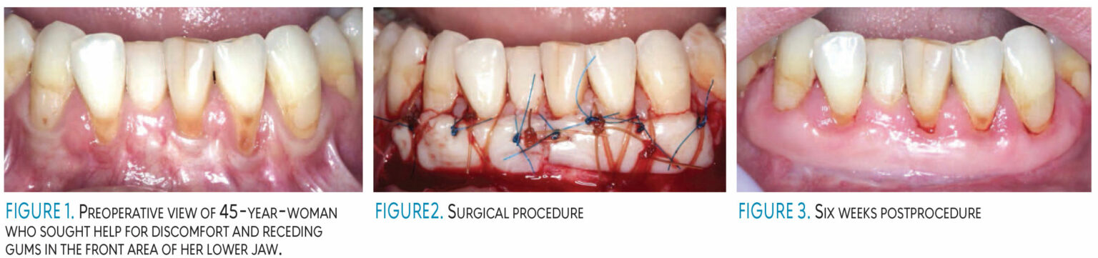 Transforming Tissues With Phenotype Modification Therapy - Dimensions ...