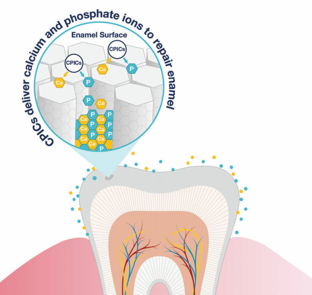 An Innovative Approach to Enamel Regeneration - Dimensions of Dental ...