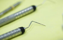 Removing Burnished Calculus - Dimensions of Dental Hygiene