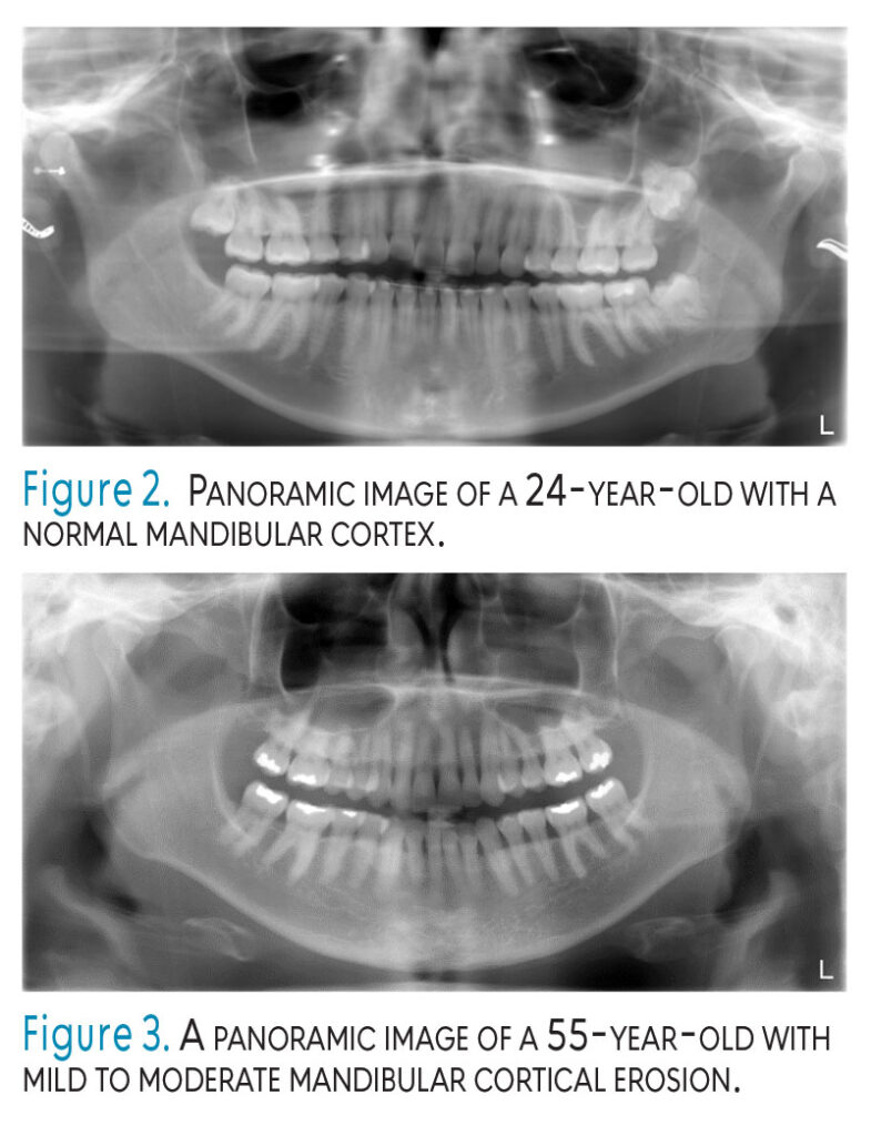 Tips for Identifying Systemic Conditions and Anomalies on the Panoramic ...