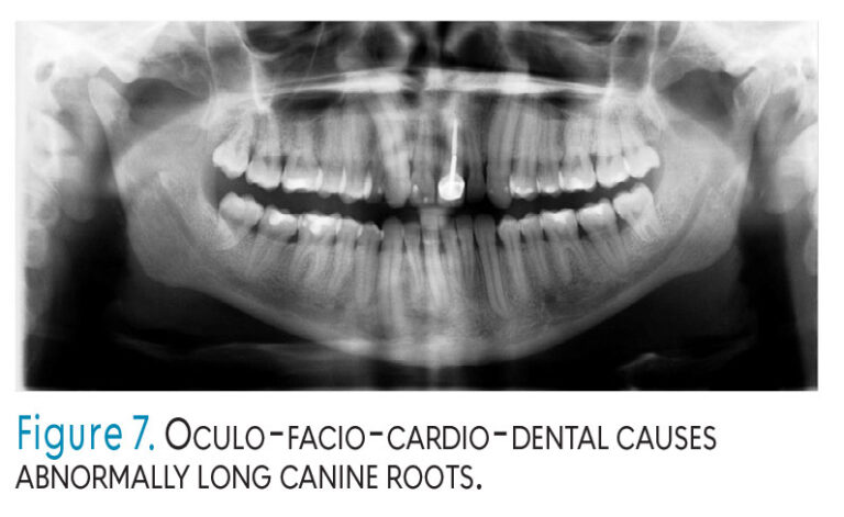Tips for Identifying Systemic Conditions and Anomalies on the Panoramic ...