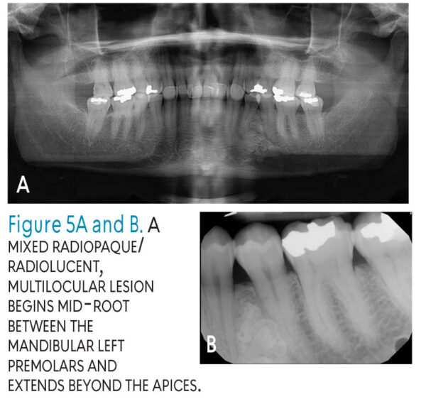 Tips for Identifying Systemic Conditions and Anomalies on the Panoramic ...