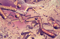 Reduce Your Panoramic Imaging Errors - Dimensions of Dental Hygiene