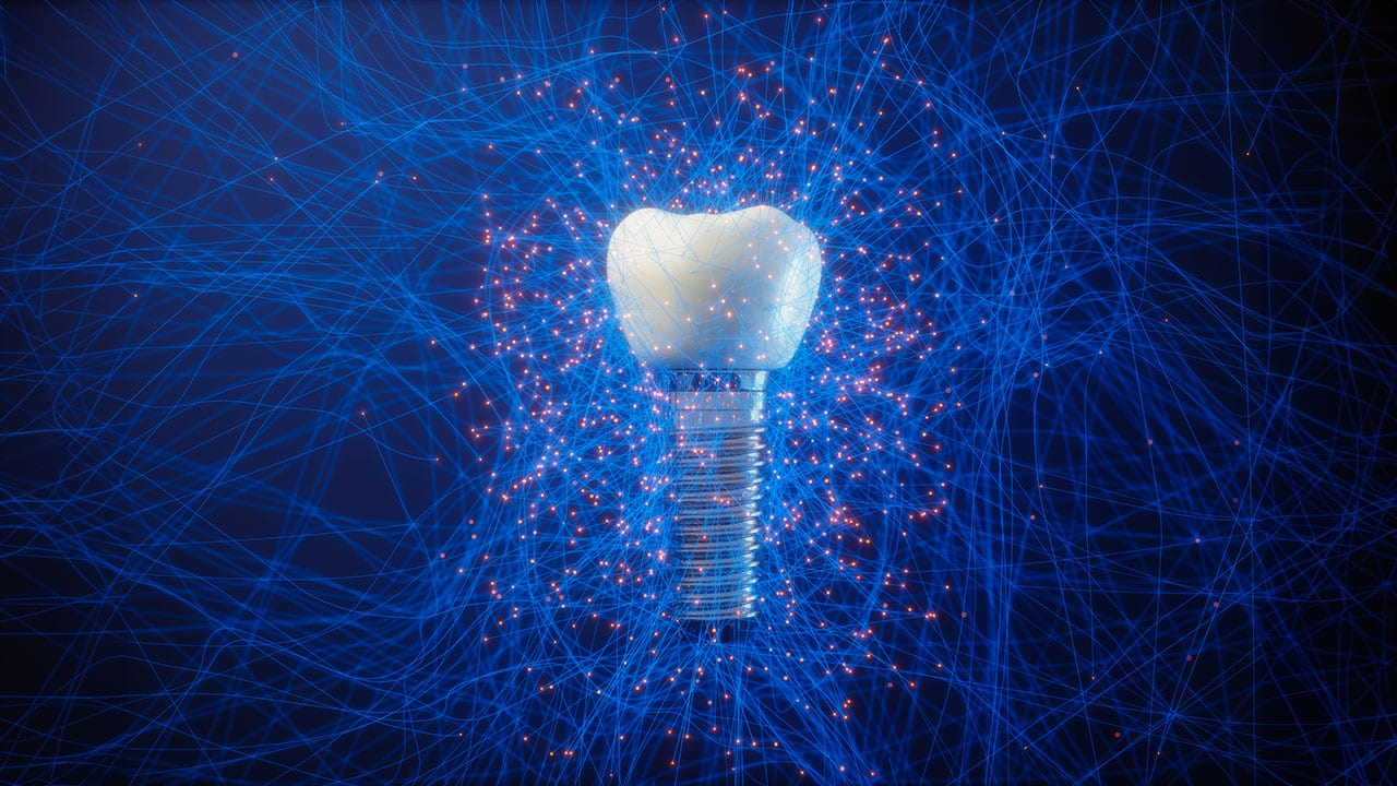 Next-Gen Dental Implants That “Feel” Like Natural Teeth Show Promise in ...
