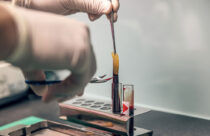 The Concept of Biologic Width in Restorative Dentistry - Dimensions of ...