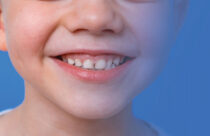 Effective Use of the AMSA Nerve Block - Dimensions of Dental Hygiene