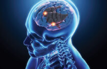 The Importance of Probes in Assessing Periodontal Health - Dimensions ...