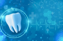 The Importance of Probes in Assessing Periodontal Health - Dimensions ...