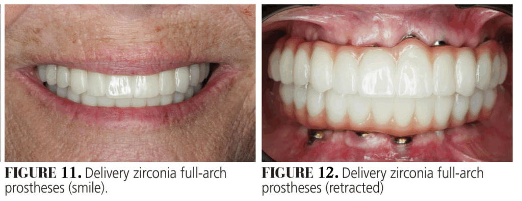 Digitally Driven Dual-Arch Transformation Restores Function and ...
