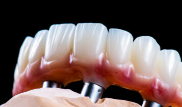Perio Update - Dimensions of Dental Hygiene