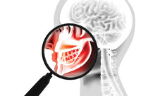 The Importance of Probes in Assessing Periodontal Health - Dimensions ...