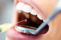 Maggots in the Mouth: The Rare but Hidden Peril of Oral Myiasis ...