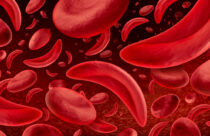 Strategies For Managing Patients With Special Needs And Disabilities