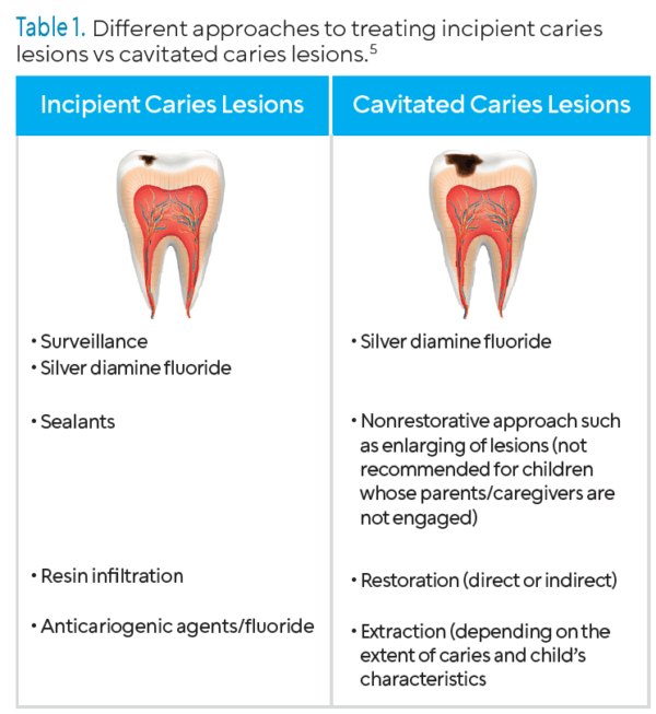 Break the Cycle of Early Childhood Caries - Dimensions of Dental Hygiene