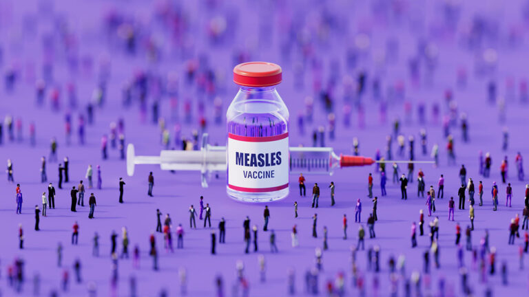 Measles Is Back: The Preventable Disease Threatening Modern Practice ...